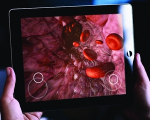 Medical Animation | Random42 Scientific Communication